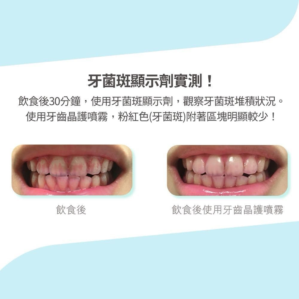 #心得 牙齒美白自己做省錢又有效‼️三款Lab52齒妍堂美白牙齒好物分享 焦凡凡代言🔥最溫和的美白牙膏推薦㊙️抗菌除臭口腔噴霧改善黃牙 刷牙乾淨 雙12情報 - 新莊吳卓源𐂂 (@cora ...