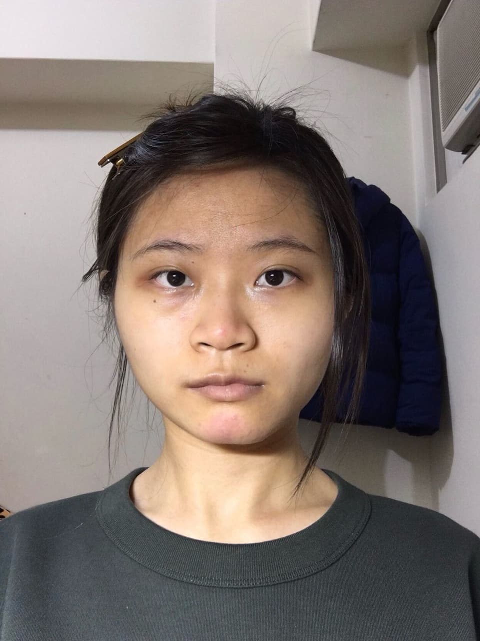 矯正即將接近尾聲，但嘴巴還是歪歪的 - 牙齒矯正板 | Dcard