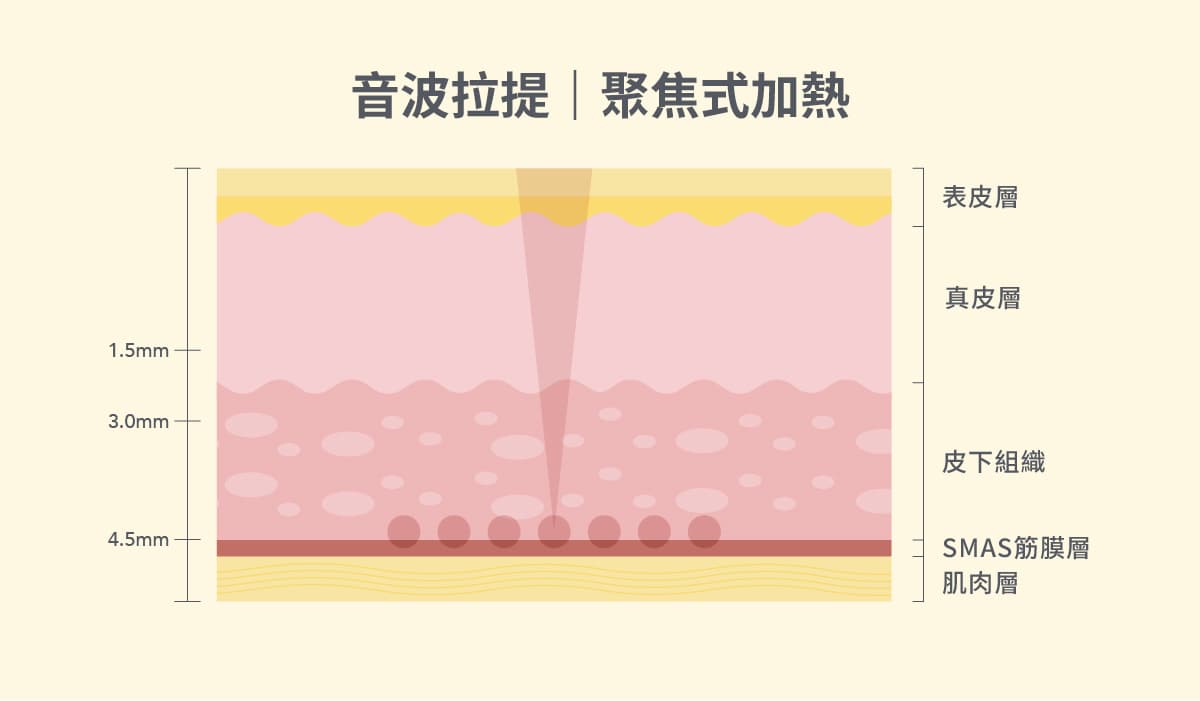 #分享 光靚肌膚保養必修課Lesson3：電音波維持肌齡 - 光靚美學診所 (@brightclinic) | Dcard