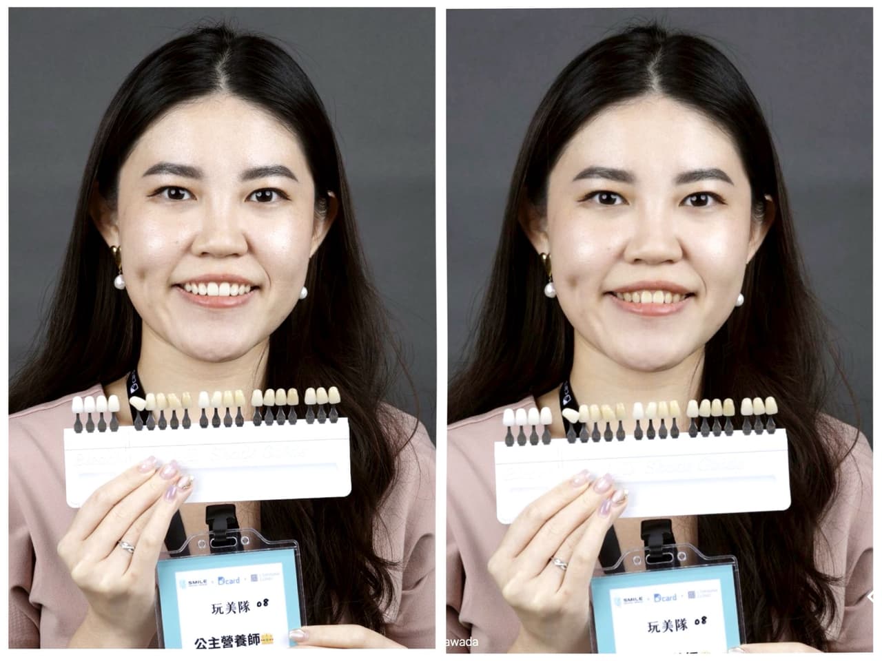 為什麼有的人笑起來特別好看？ - 公主營養師👑 (@princess_rd) | Dcard