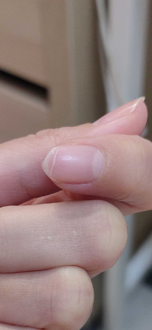 問題 卸甲後指甲軟又裂開😭😭😭 美甲板 Dcard