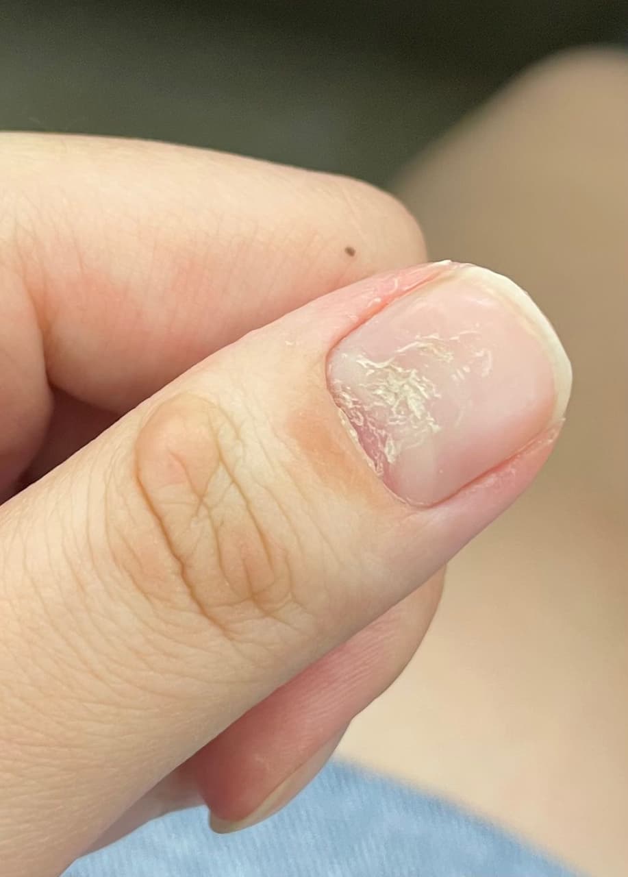 問題 指甲很醜怎麼辦😣 美甲板 Dcard
