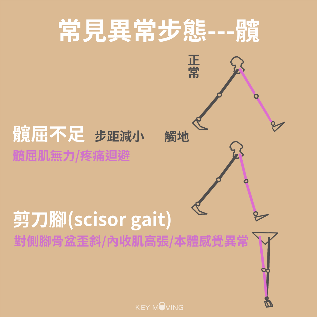 步態分析的最後一哩路 - 還有夢想的物理治療師 (@bo_soul) | Dcard