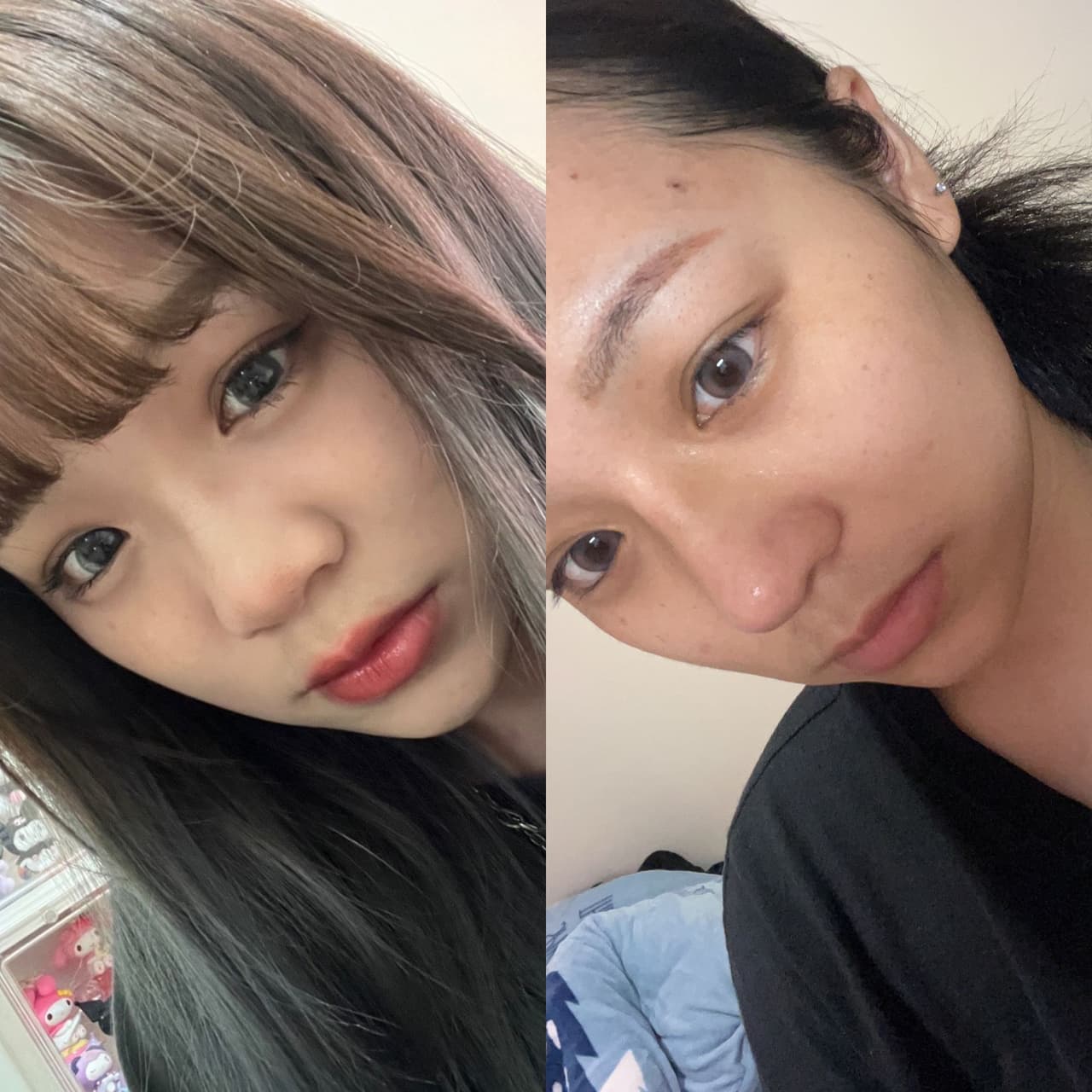 #分享 #圖多 #文長 終於去隆鼻啦！ - B107 留言 | Dcard