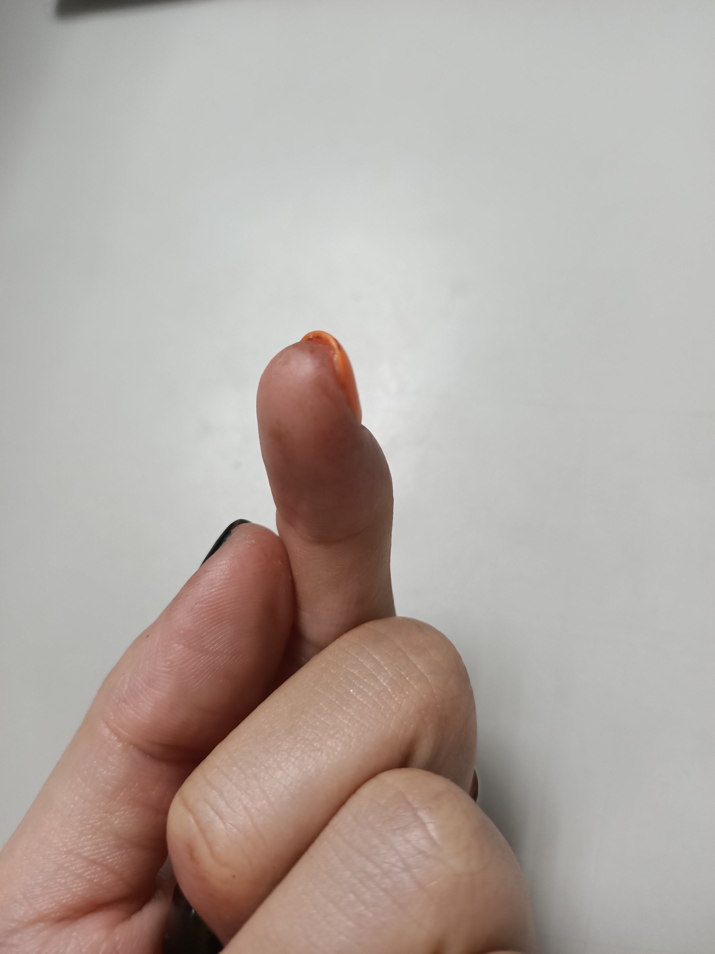 問題 自己做凝膠美甲 指腹卻紅腫增厚脫皮😢 美甲板 Dcard