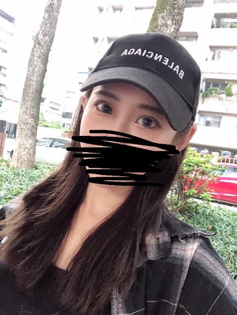 #更#圖 縫雙眼皮完全不痛！滿月分享 - B175 留言 | Dcard