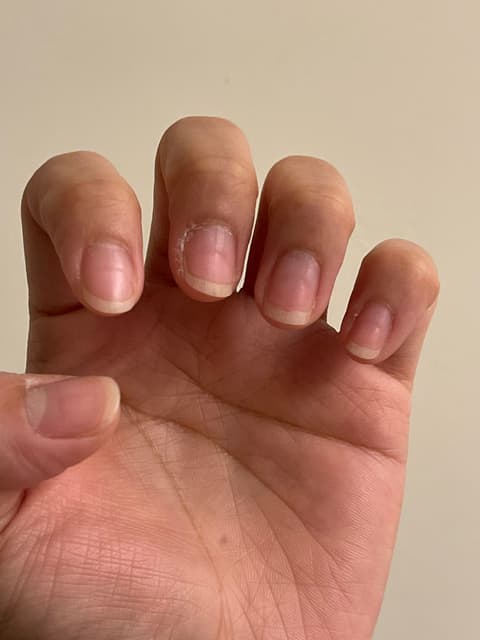問題 指甲這樣是生病了嗎 美甲板 Dcard