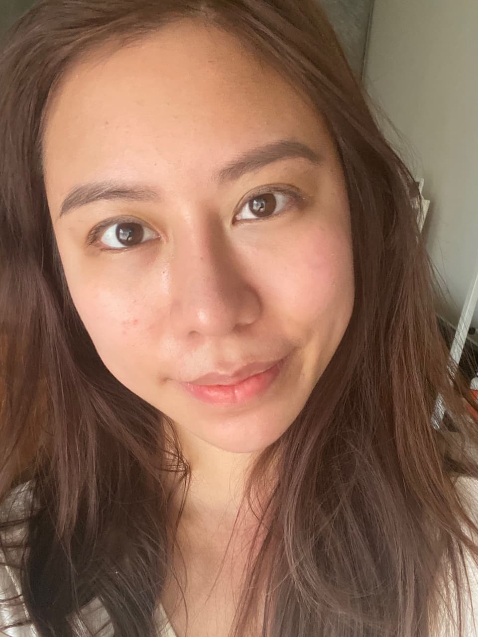 #分享 高雄割雙眼皮 - 醫美板 | Dcard