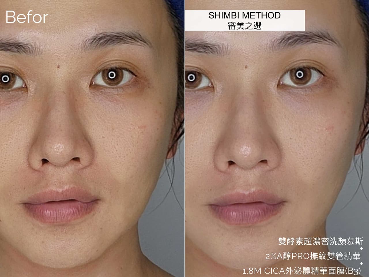 這瓶A醇雙管精華讓我美貌續命！溫和有感的新選擇｜SHIMBI METHOD 審美之選 - YUKI (@yukitseng15) | Dcard