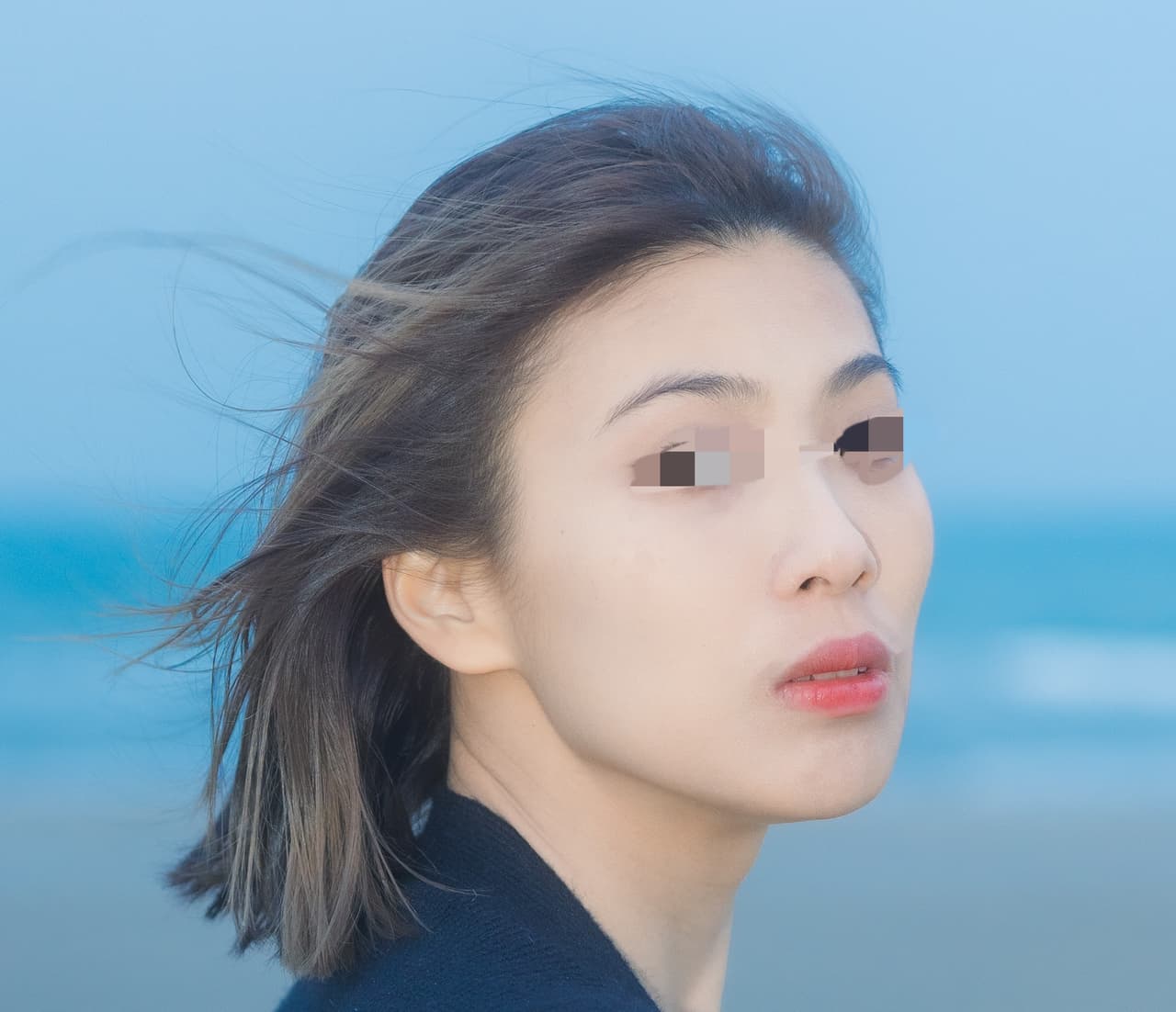 #請益 （更）高顴骨嘴凸牙齒矯正方案 - 牙齒矯正板 | Dcard