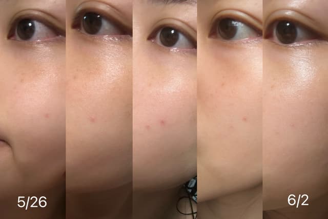 保養黑科技 薇佳超波肽外泌體藻針精華乳 - 咖苦老師☕️ (@kakusmakeup) | Dcard