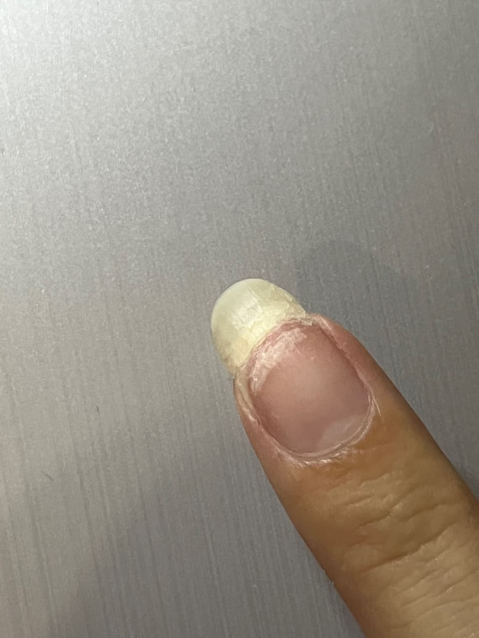 問題 請問我的指甲怎麼了 美甲板 Dcard