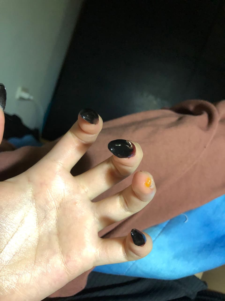 手指長水泡發霉 美甲板 Dcard