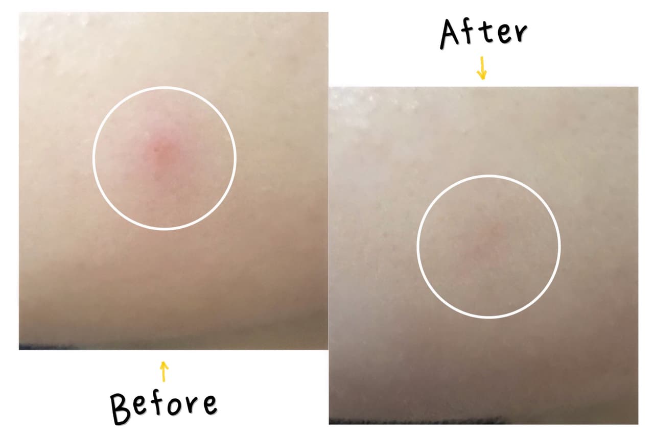 #分享 近期愛用遮瑕大公開 | MEDI247 - 美妝板 | Dcard