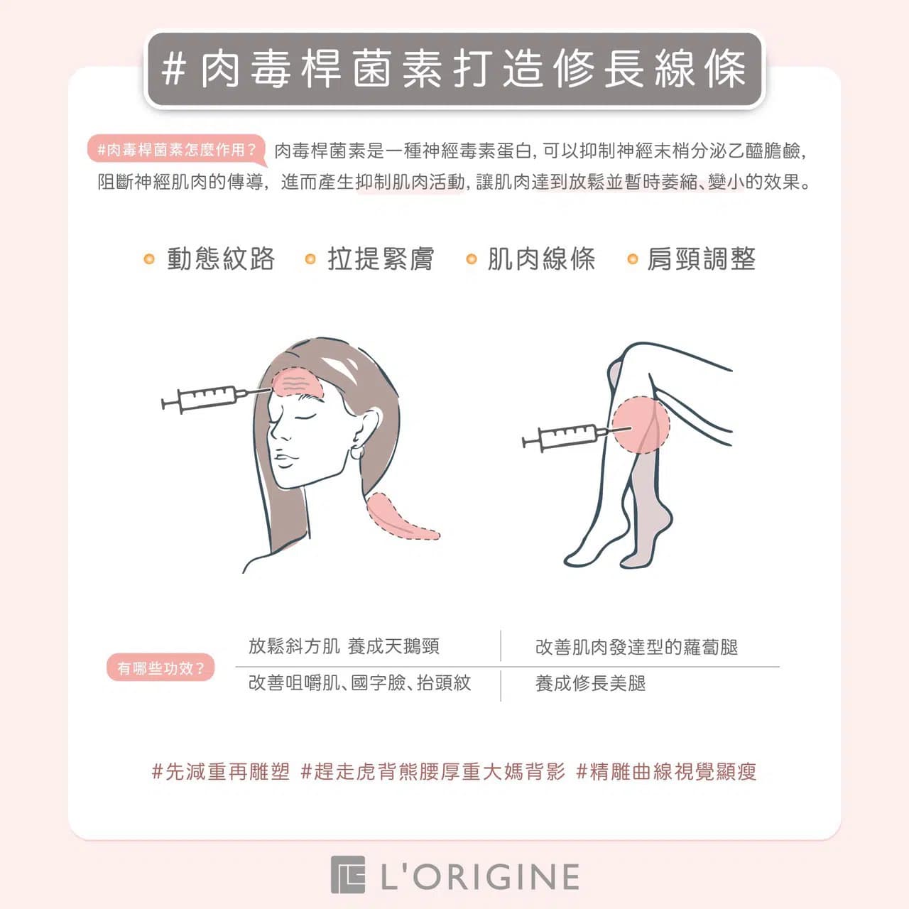 #分享 肉毒桿菌素打造纖長線條 - 原美學診所 (@lorigine) | Dcard