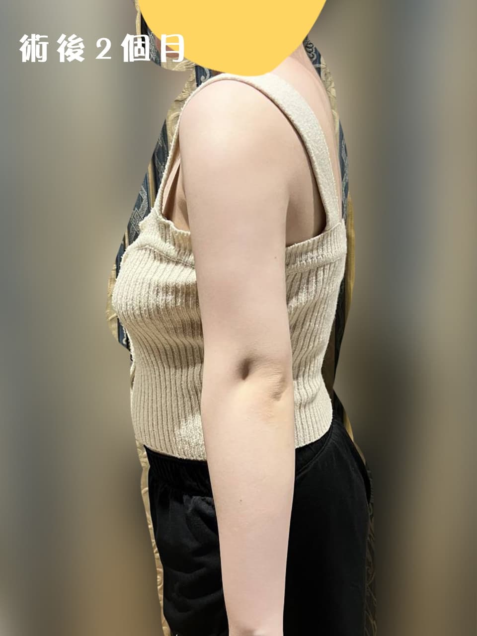 #分享 想在婚禮上穿好看的禮服當個漂亮的新娘子！ - 晶美整形 (@skin1000) | Dcard