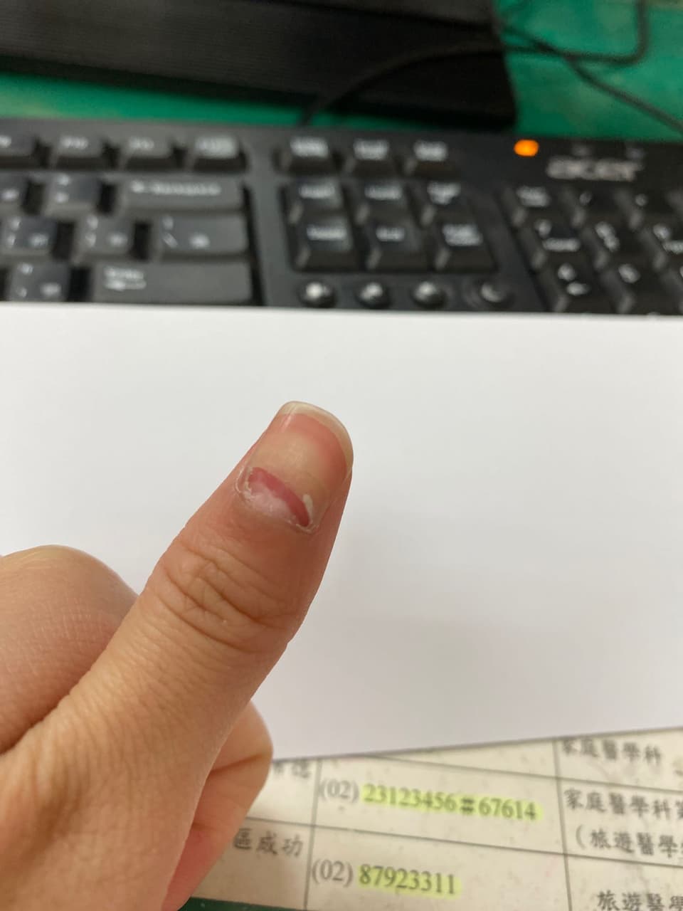 慎入內有噁圖求解 這樣可以做指甲嗎 美甲板 Dcard
