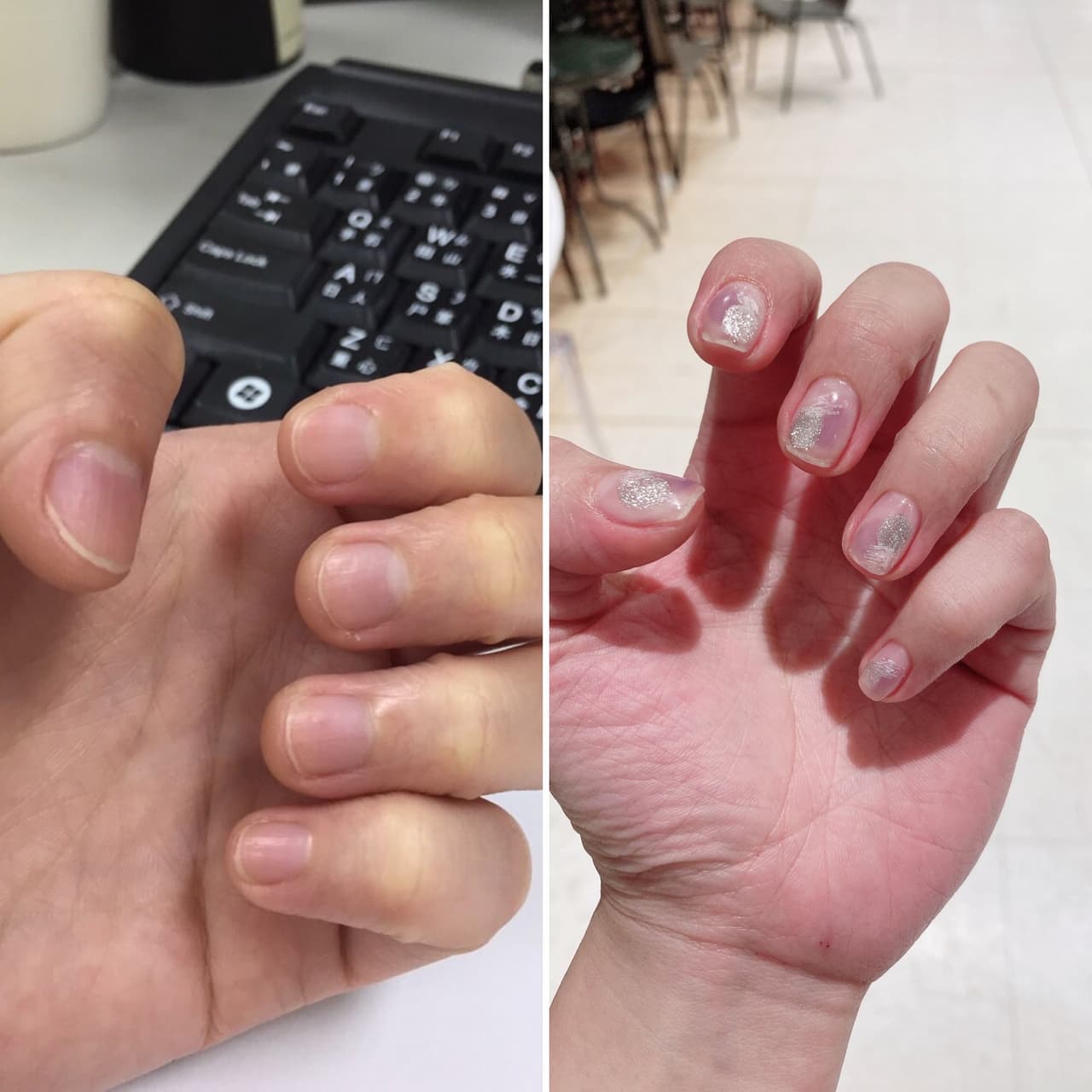 問題 手指僵硬是單純不協調,還是生病了? 美甲板 Dcard