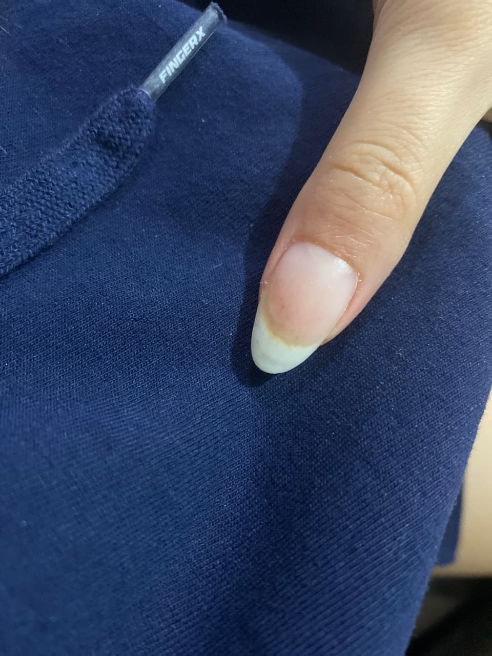 指甲發霉了嗎 美甲板 Dcard
