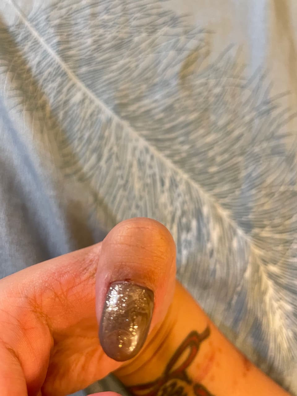 分享 十指手指頭被剪傷五隻還爆血🥹🥹🥹 美甲板 Dcard
