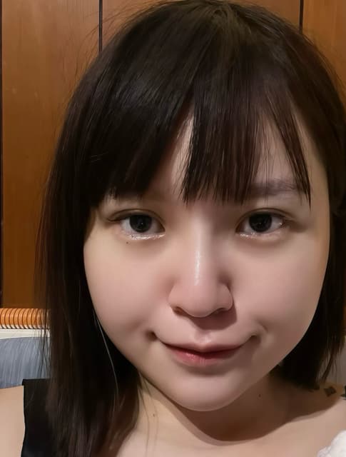 #討論 是否重縫雙眼皮 - 醫美板 | Dcard