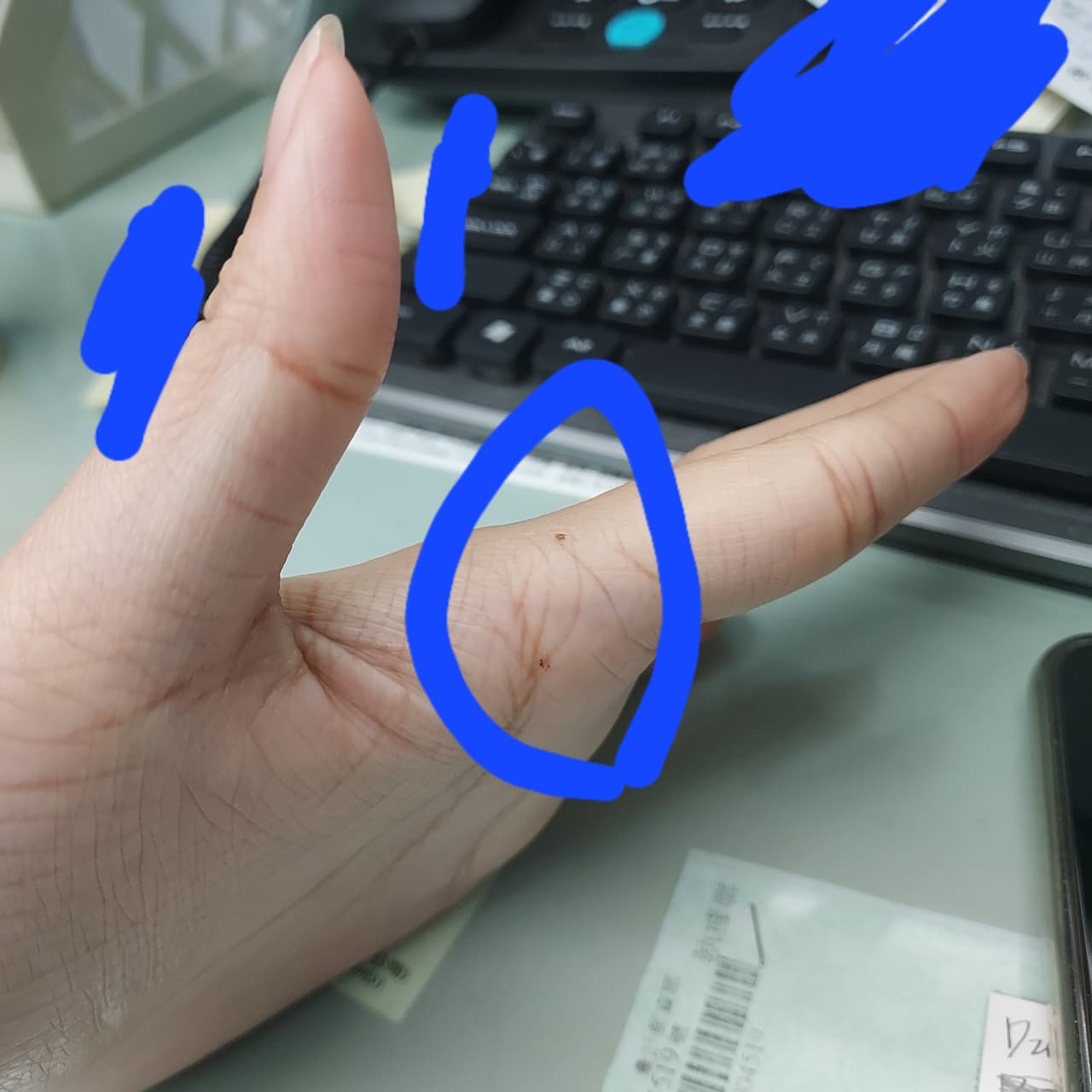 發問 痣太多很困擾 問答板 Dcard