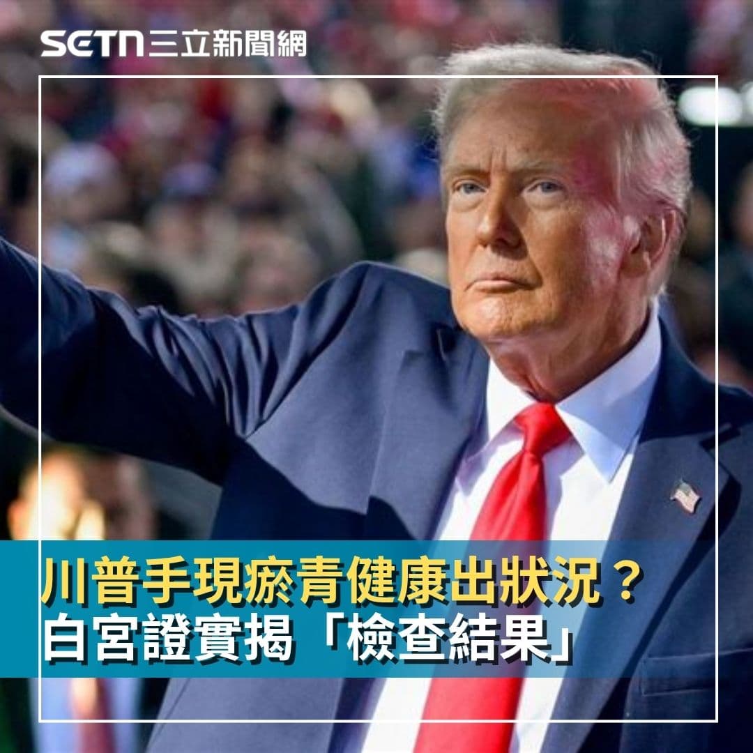 川普手現神秘瘀青健康出狀況？白宮證實揭檢查結果：慢性靜脈功能不全 - SETN三立新聞網 (@setn54) | Dcard
