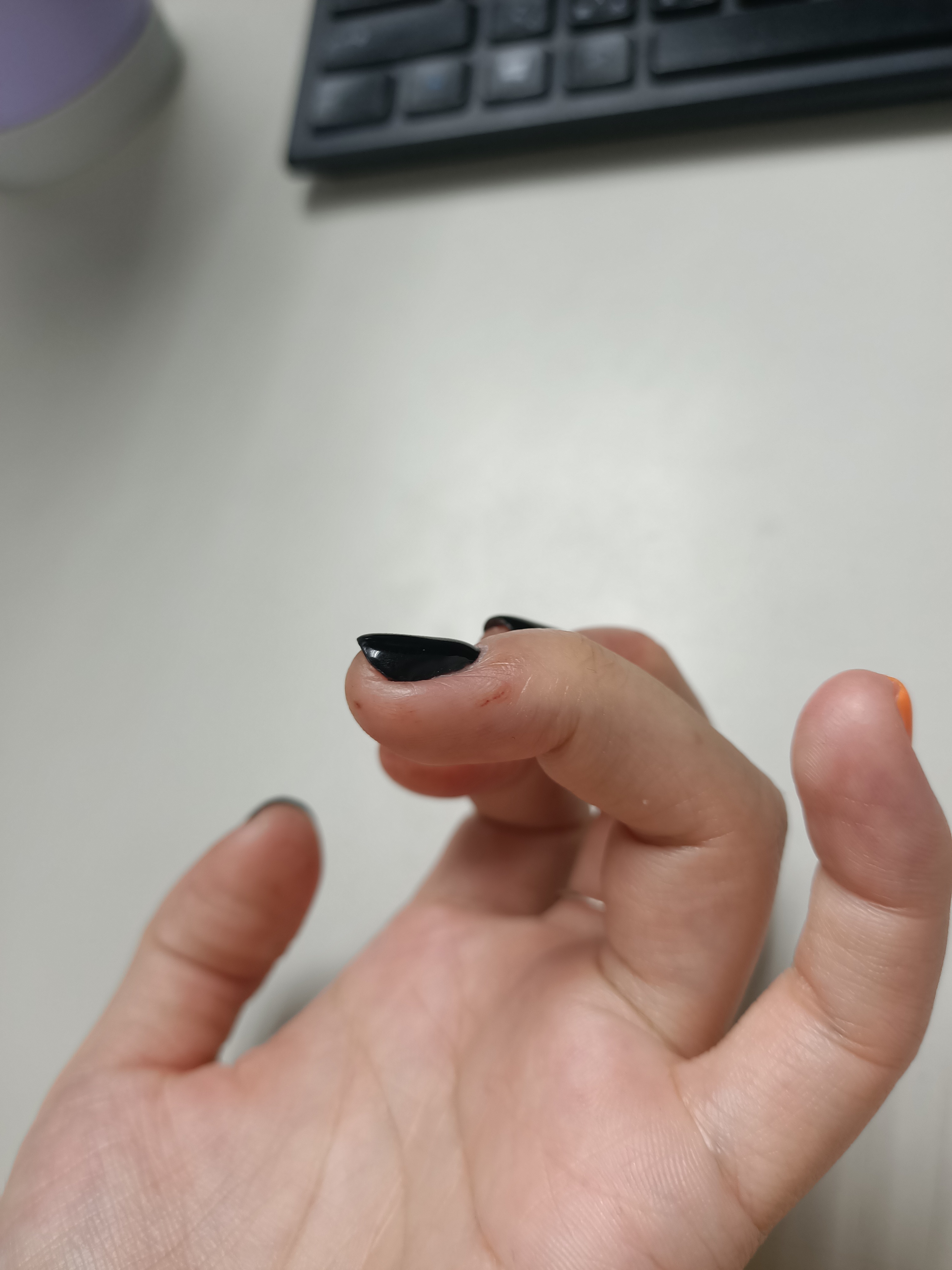 問題 自己做凝膠美甲 指腹卻紅腫增厚脫皮😢 美甲板 Dcard