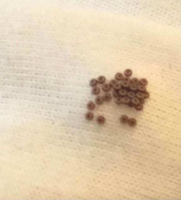 請益 請問這是什麼蟲的卵😖 昆蟲板 Dcard