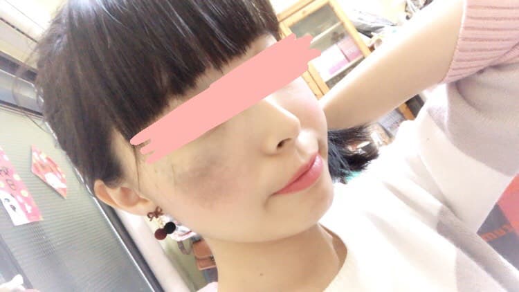 #分享 covermark 超強遮瑕術（相信你的眼睛！！） - B41 留言 | Dcard