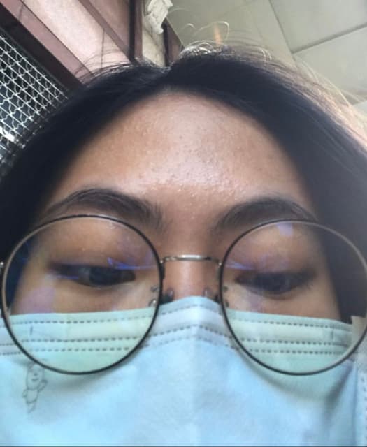 #更 掰掰了閉鎖性粉刺 👩🏼 - B138 留言 | Dcard