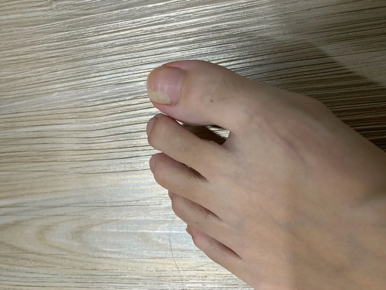 問題 指甲這樣可以做美甲嗎? 美甲板 Dcard