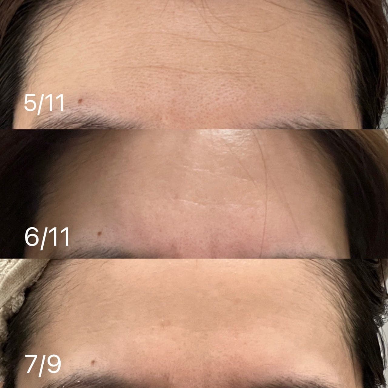 A醇使用分享 - 喜歡簡單保養的商品開發 (@davin1982) | Dcard