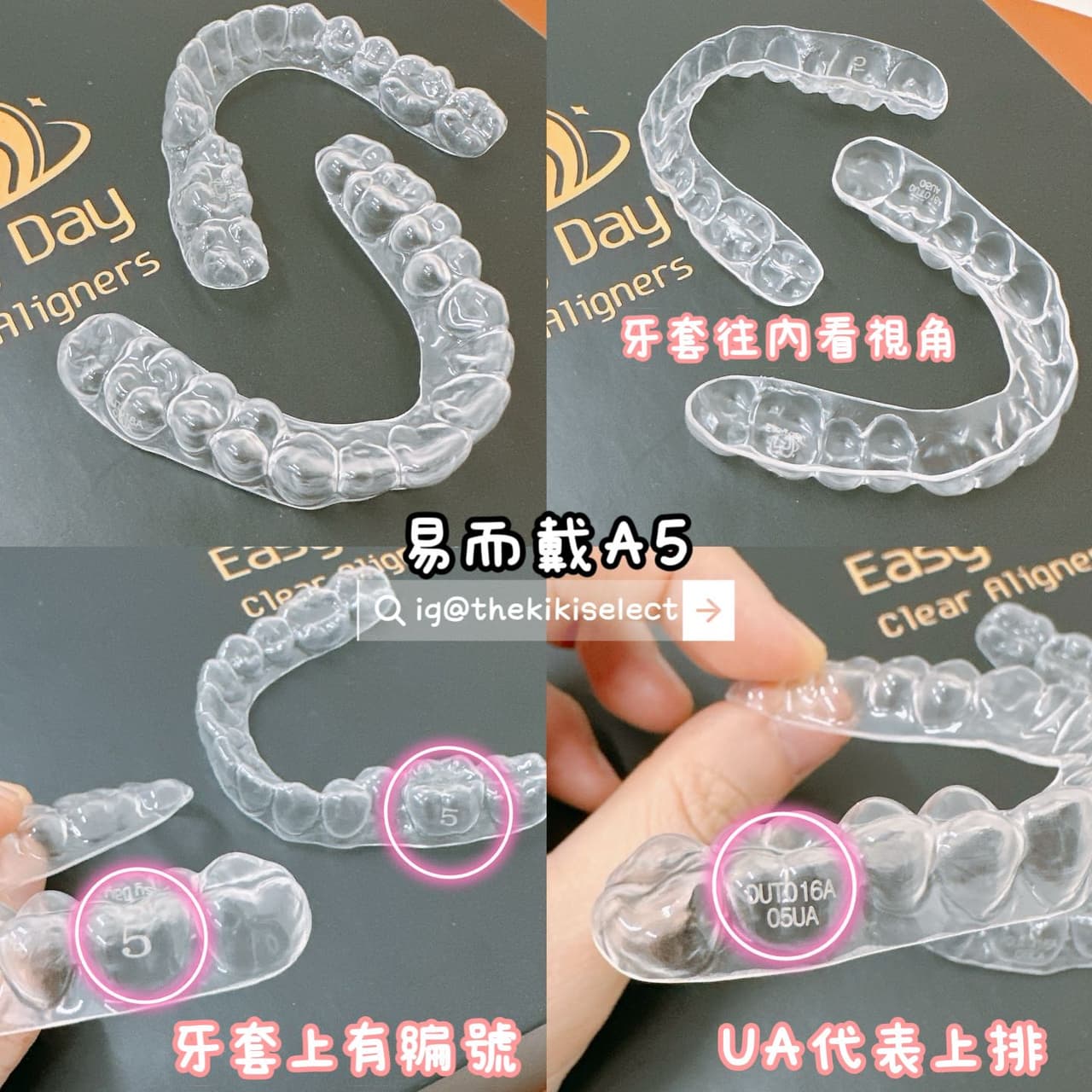 終於開始的矯正⼈⽣ 隱形牙套易⽽戴A1～A5 記錄分享 - 牙齒矯正板 | Dcard