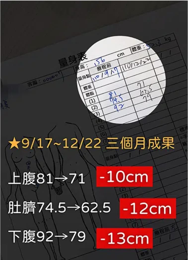 #案例分享 部落客啾啾完美蛻變 12週從M號穿回S號 - 原美學診所 (@lorigine) | Dcard