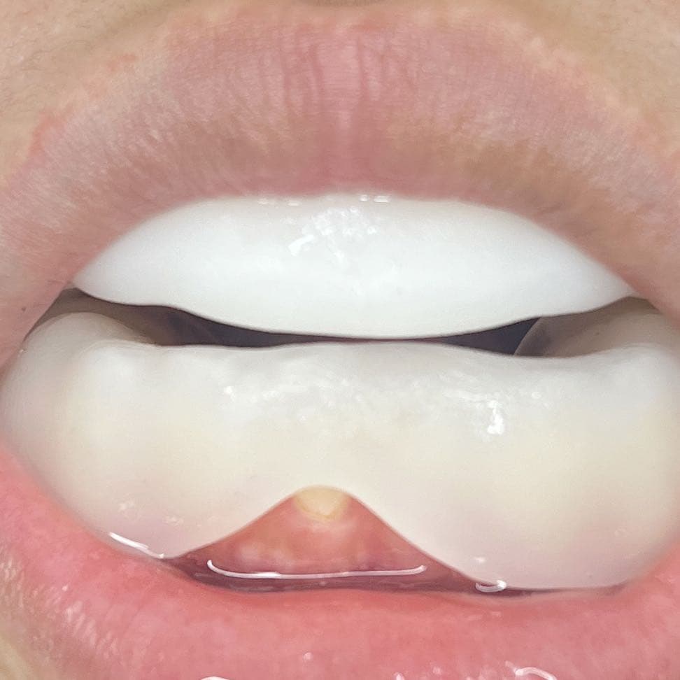 #分享 #好物生活提案 牙齒真的變白了🦷還可以DIY齒模！｜Lab52齒研堂 - 美妝板 | Dcard