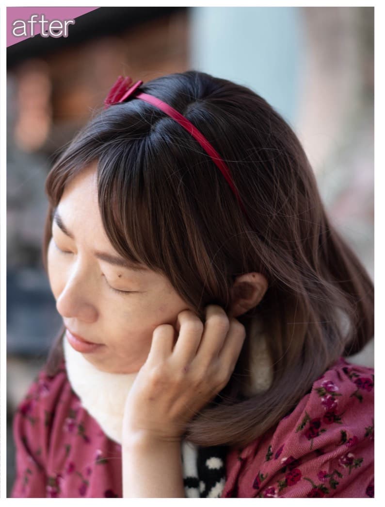 告別痘痘、蠟黃等肌膚問題 邁向素顏健康美肌 - 十分肌膚管理 (@skin_beauty_10) | Dcard