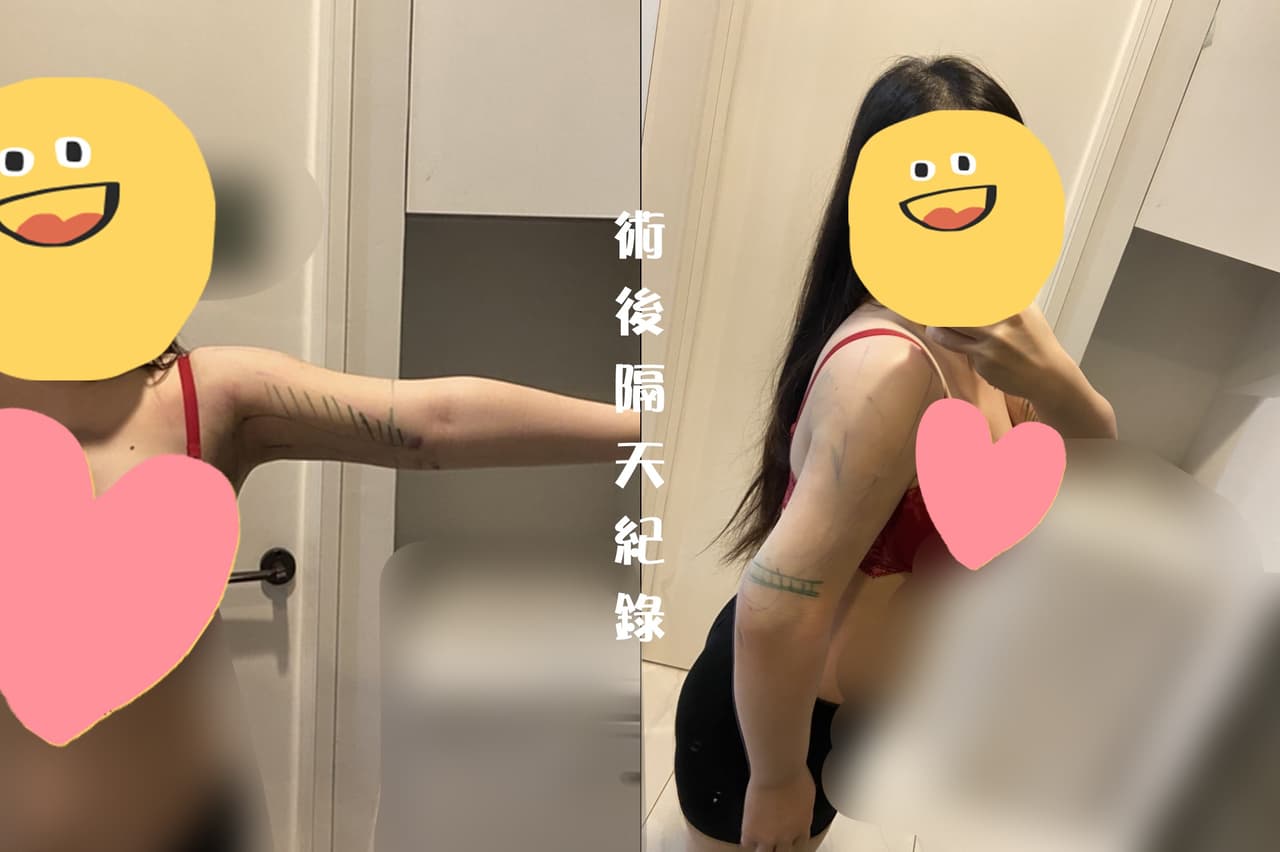 #分享 想在婚禮上穿好看的禮服當個漂亮的新娘子！ - 晶美整形 (@skin1000) | Dcard
