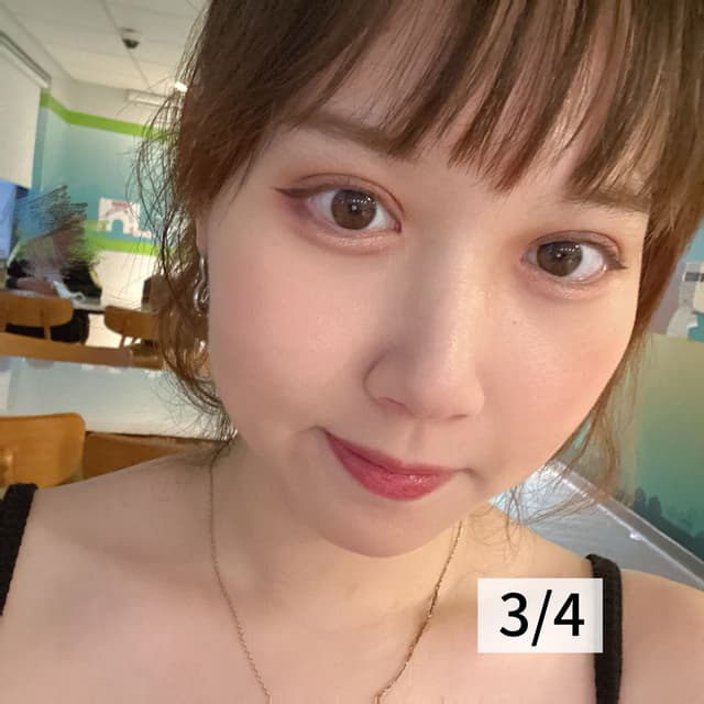 #分享 割雙眼皮超過一個月了！⚠️有臉照慎入 - 醫美板 | Dcard