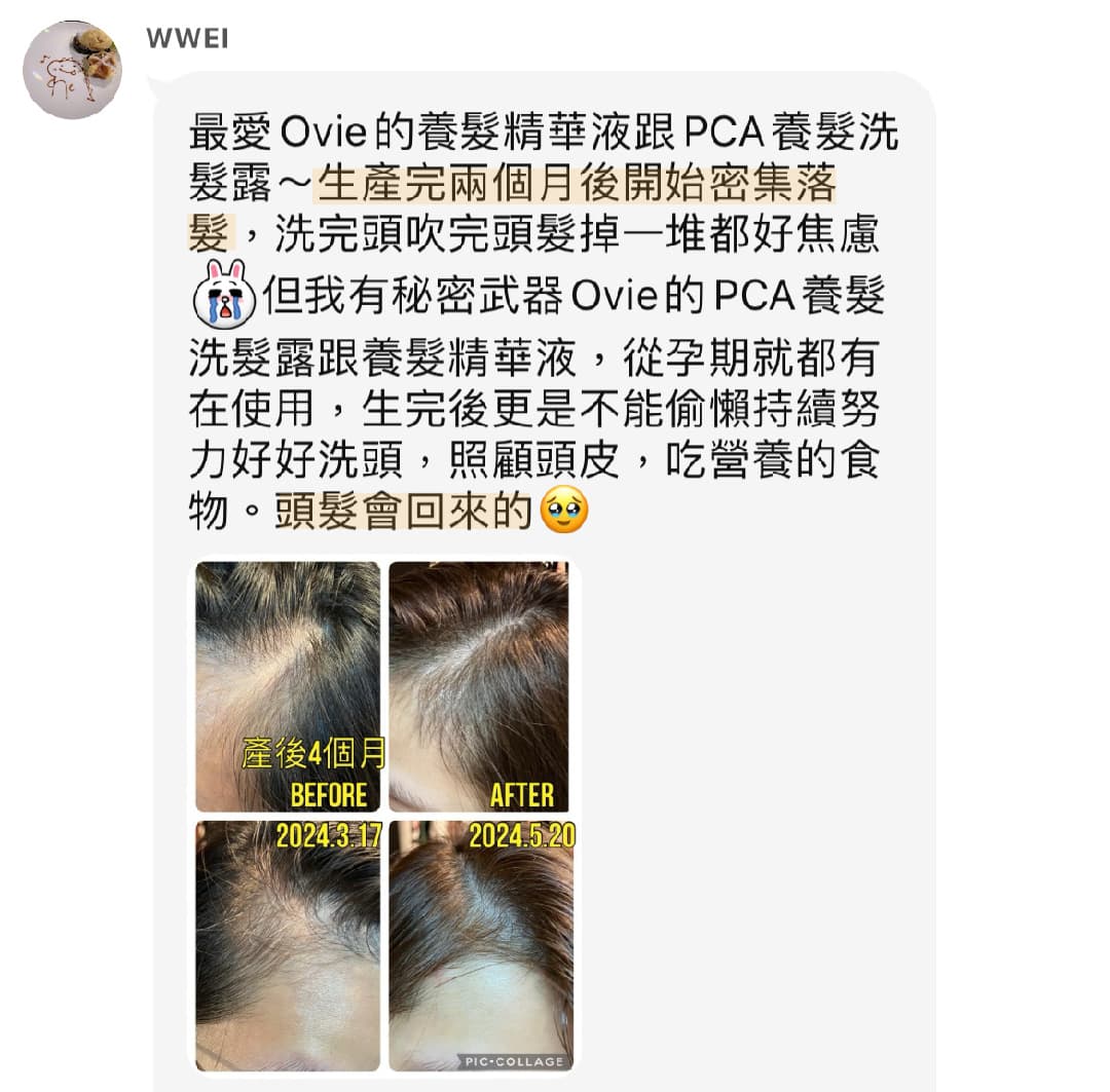 # ovie 養髮三部曲 染燙受損就靠頭皮養護的系列護髮品來拯救！🎀🧴🫧文末有隱藏版ovie優惠！ - ovie 精油芳療專科 (@ovie_tw) | Dcard