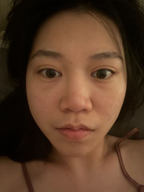 #討論 臉圓的困擾，削骨？、電波？ - 醫美板 | Dcard