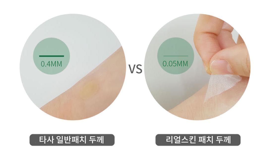 NOT4U Real Skin Patch 液體痘痘貼 - 美妝板 | Dcard