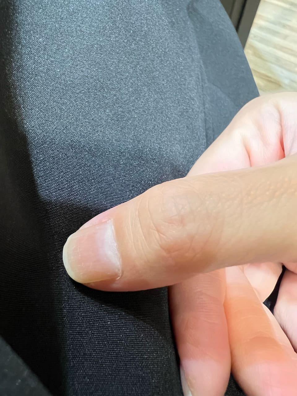 問題 指甲變黃 美甲板 Dcard