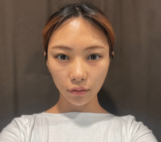 #分享 去韓國本思醫院做醫美經驗！🇰🇷 - 品牌商家 (@brand_selection) | Dcard