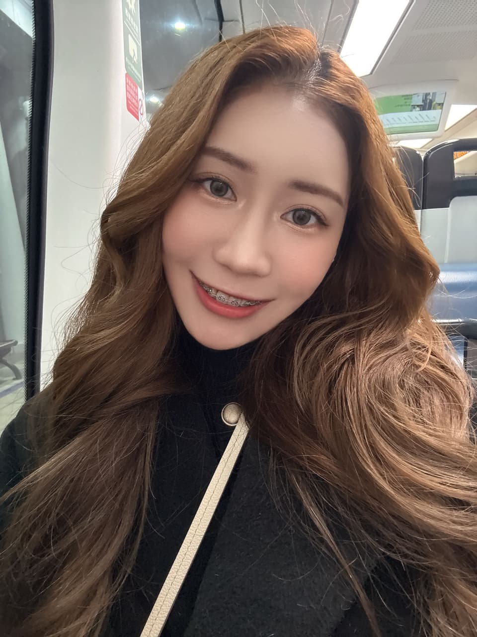 牙套第五個月…. - Sunni🐱 (@sunniandcats) | Dcard