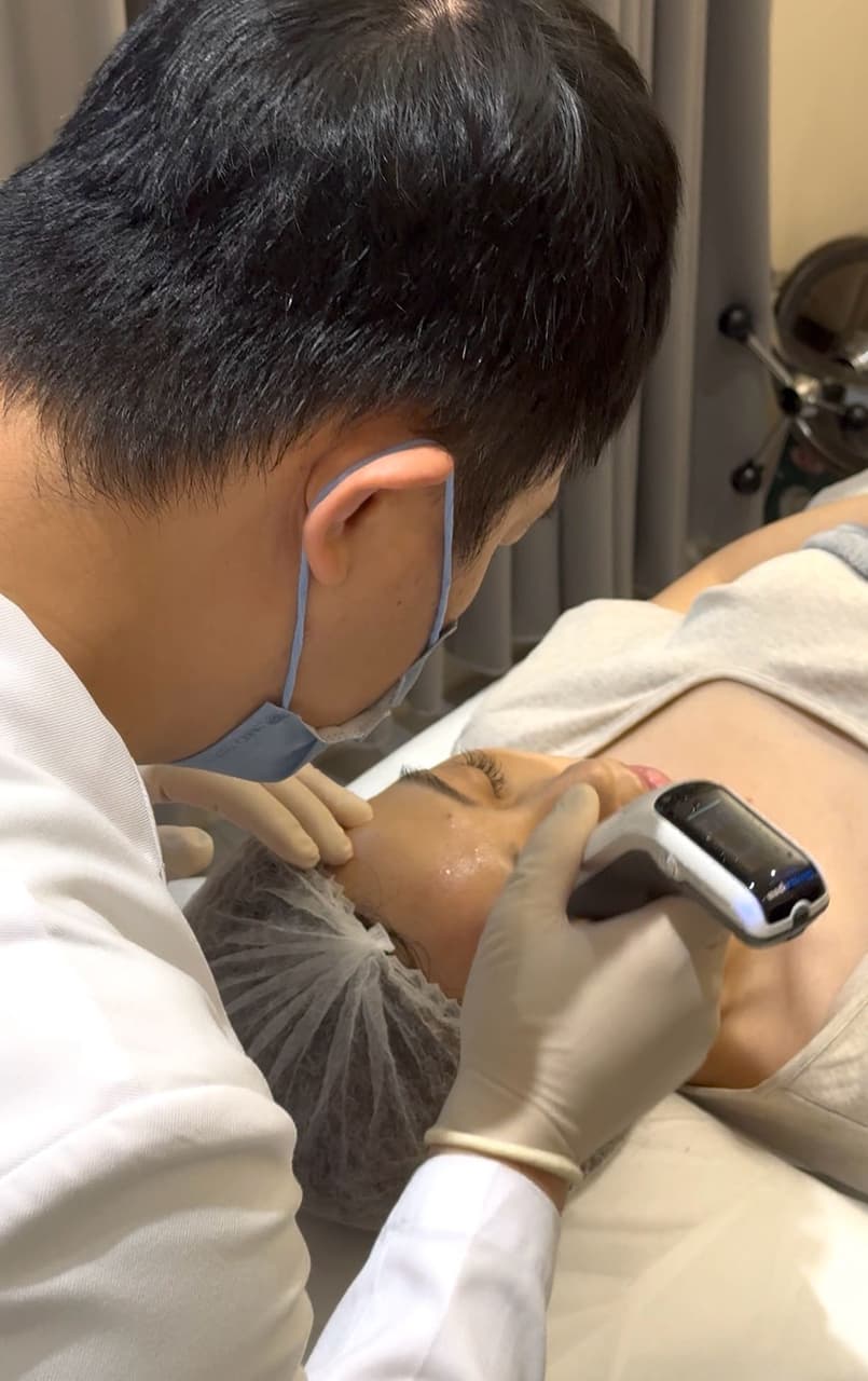 #分享 台北悅x) 得美微針筆 + PRP 改善痘痘＆痘印｜分享療程過程與效果 - 醫美板 | Dcard