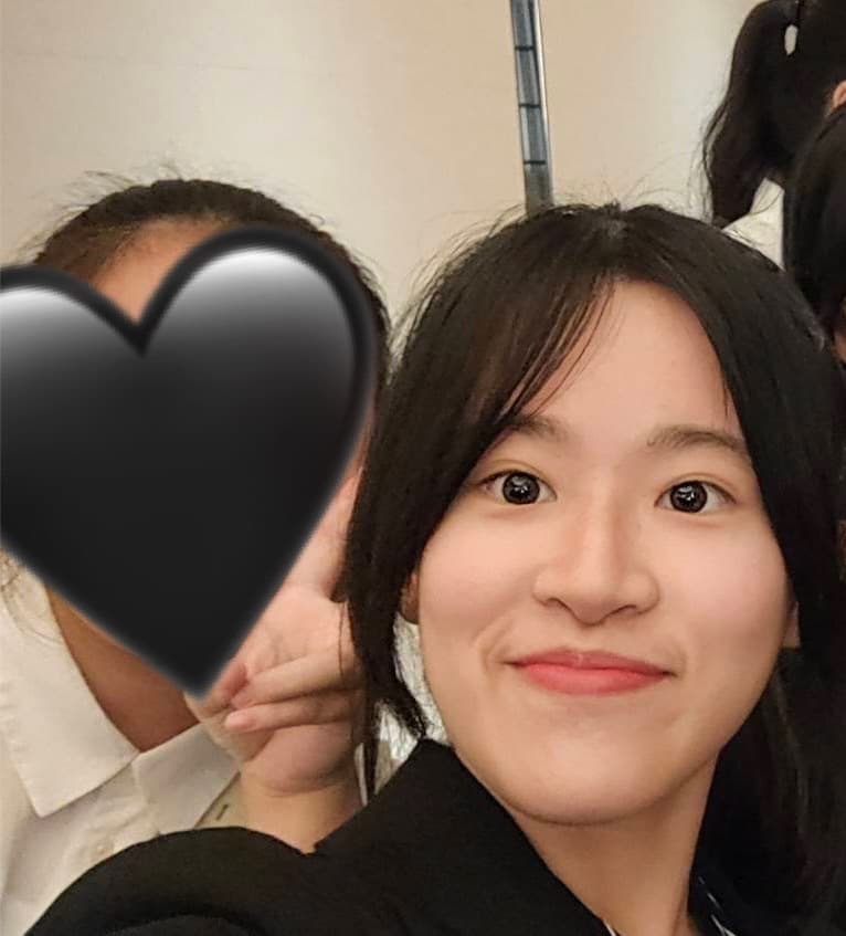 #分享 前額拉皮手術讓我更有自信!(術後三個月更新) - 醫美板 | Dcard