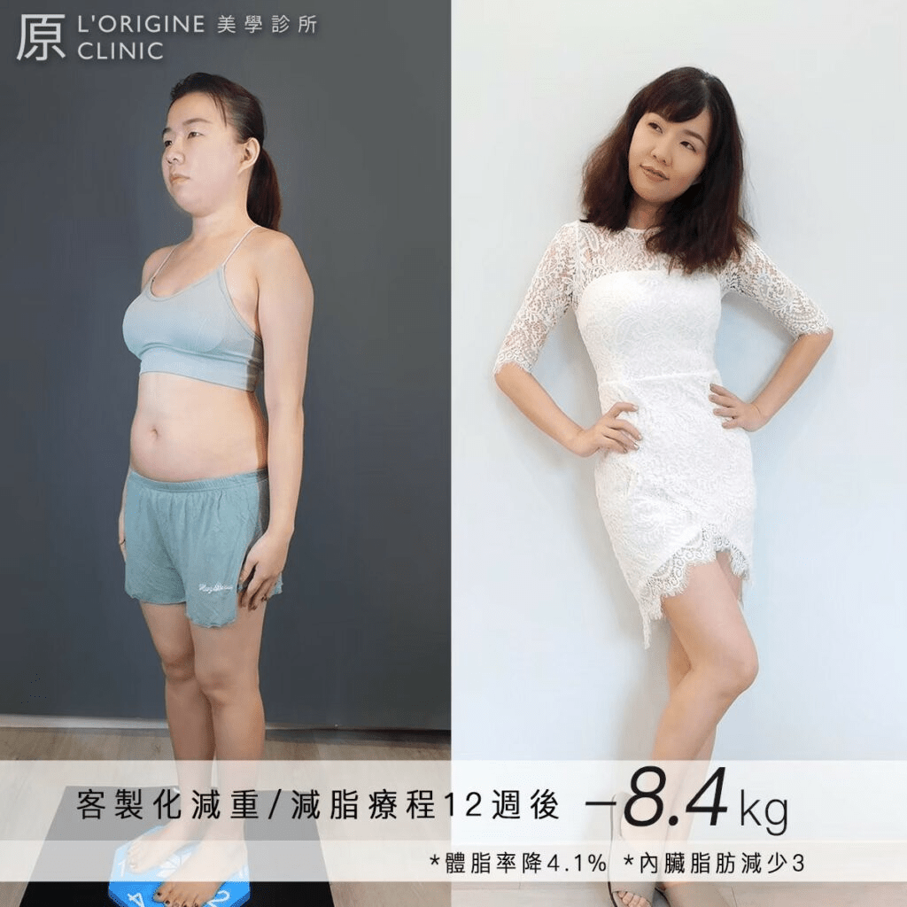 #知識 多囊性卵巢症候群 妳知多少？ - 原美學診所 (@lorigine) | Dcard