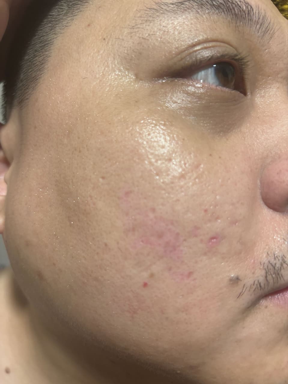 #討論 分享 ｜ 幫先生用TCA及早C晚A保養 - 美妝板 | Dcard