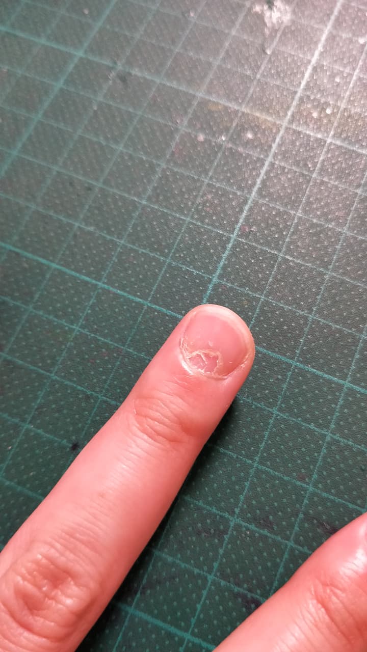問題 請問指甲怎麼了?😥 美甲板 Dcard